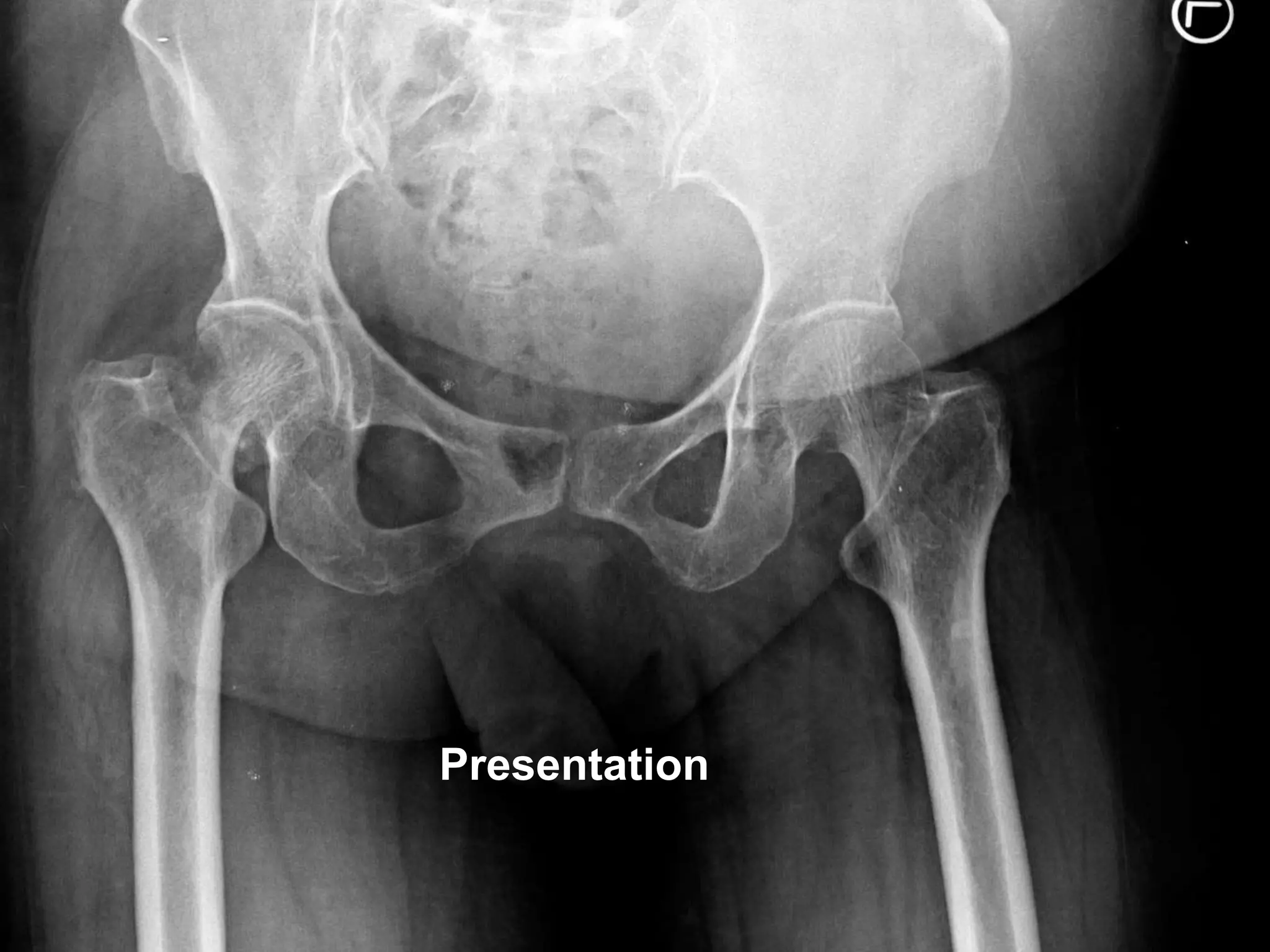 Nof fixation sequence | PPTX