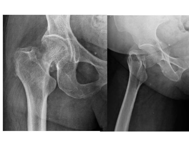 Nof fixation sequence | PPTX