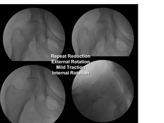 Nof fixation sequence | PPT