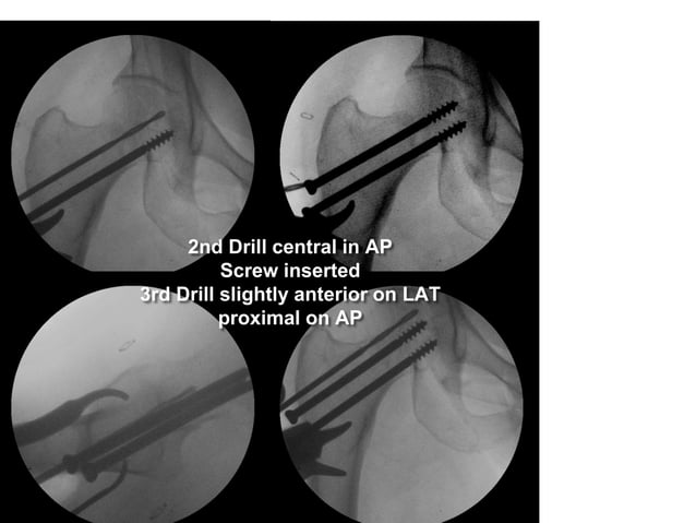 Nof fixation sequence | PPT