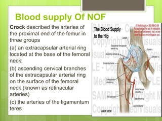 Nof fracture | PPT