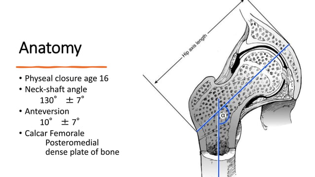 Neck of femur fracture. Power point presentation | PPTX