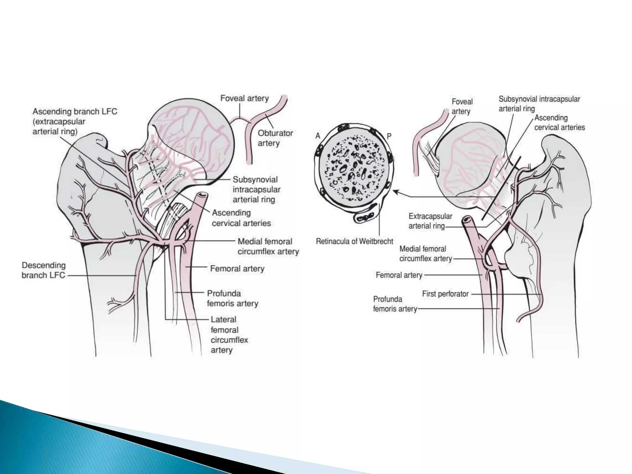 Proximal Femur Fractures with NOF & IT | PPTX
