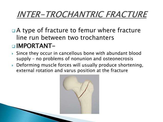 Proximal Femur Fractures with NOF & IT | PPT