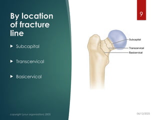 Approach to neck of femur fractures in district hospitals | PPT
