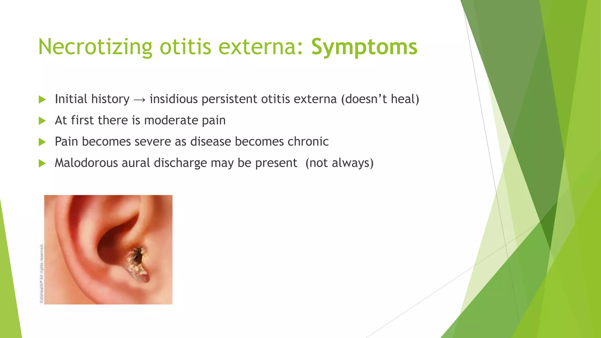 Necrotizing Otitis Externa | PPTX