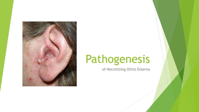 Necrotizing Otitis Externa | PPTX | Ear, Nose and Throat Conditions ...