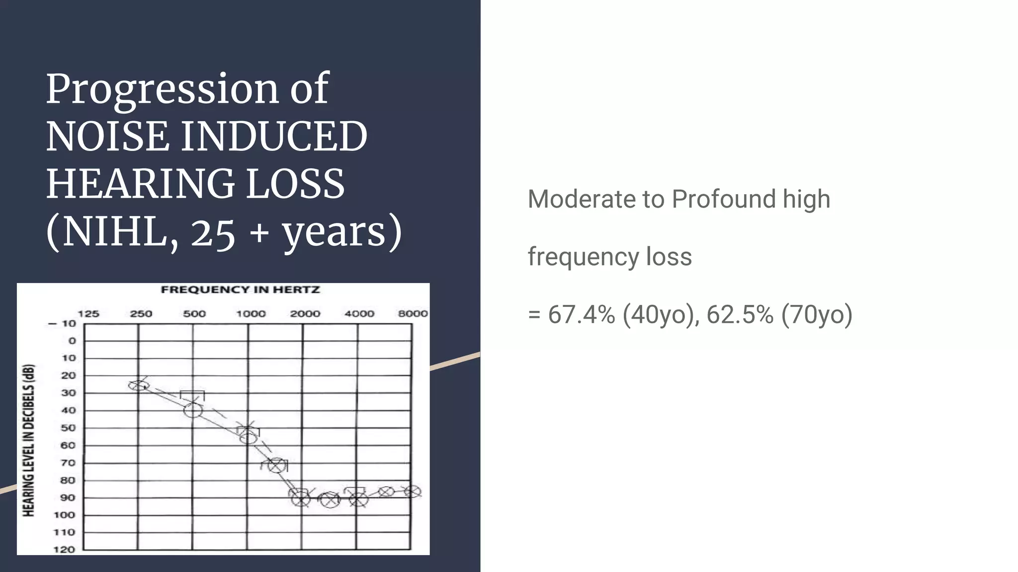 NOISE INDUCED HEARING LOSS (NIHL) | PPTX