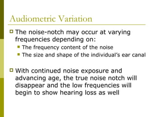 Noise-Induced Hearing Loss | PPT