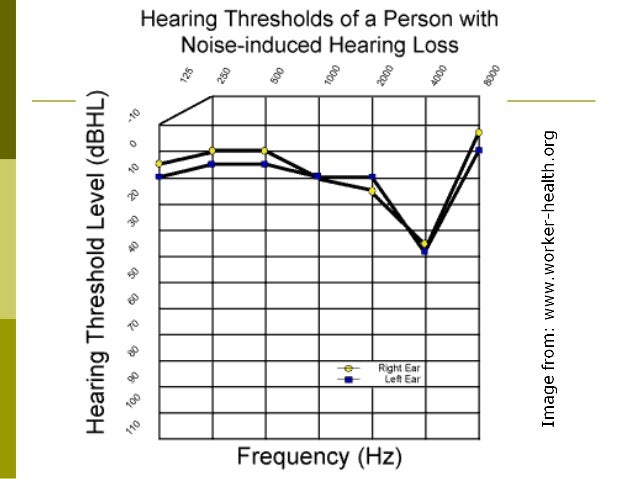 Noise-Induced Hearing Loss