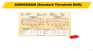 Occupational Safety & Health (Noise Exposure) Regulations 2019 ...