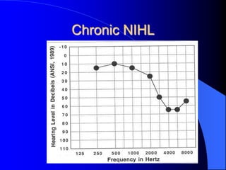 Noise Induced Hearing Loss.ppt
