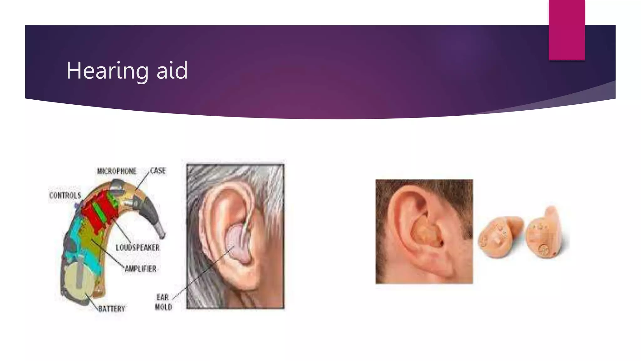 noise induced hearing loss.pptx