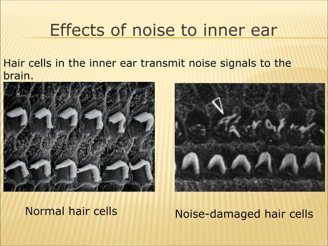 Noise pollution and its control BY Muhammad Fahad Ansari 12IEEM14 | PPT