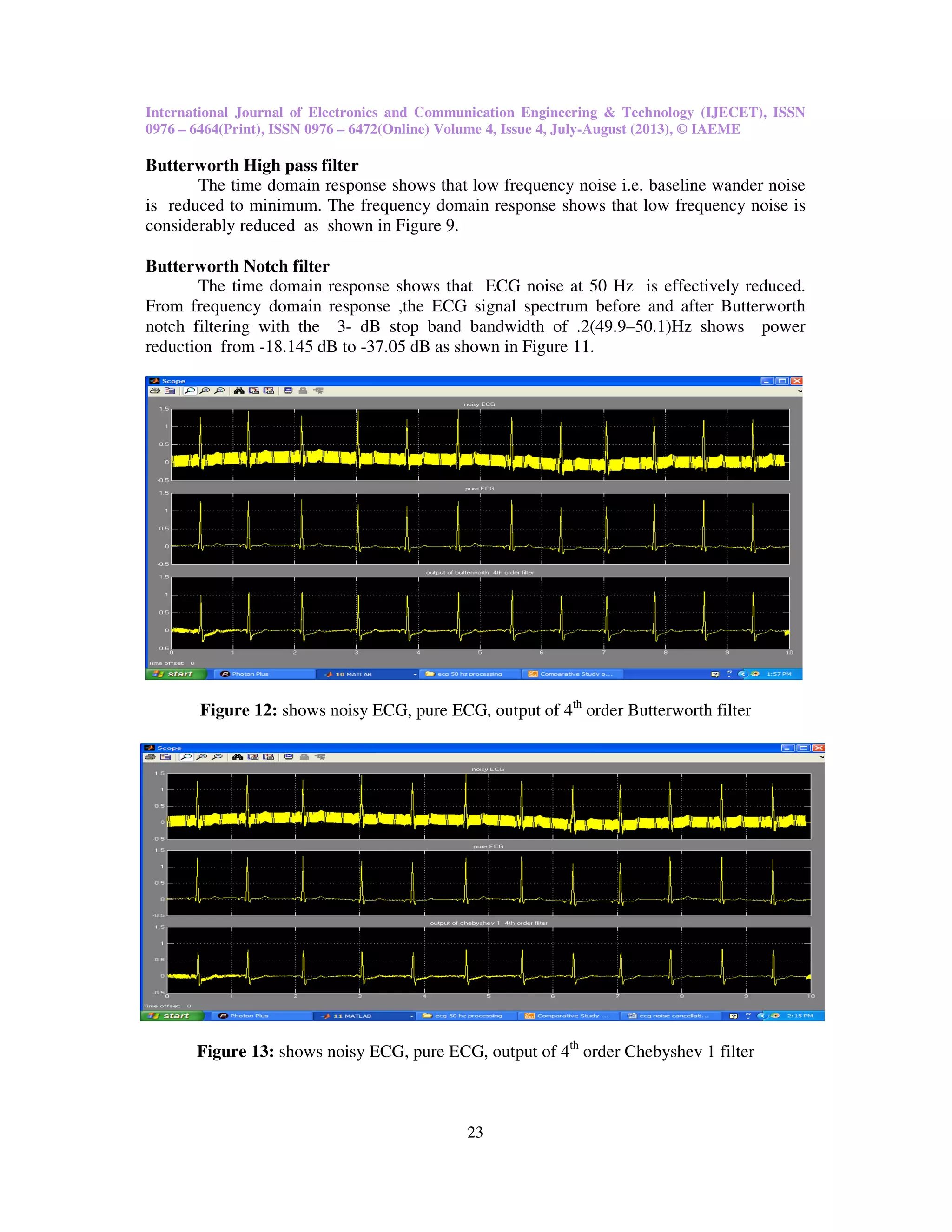 Noise reduction in ecg by iir filters a comparative study | PDF