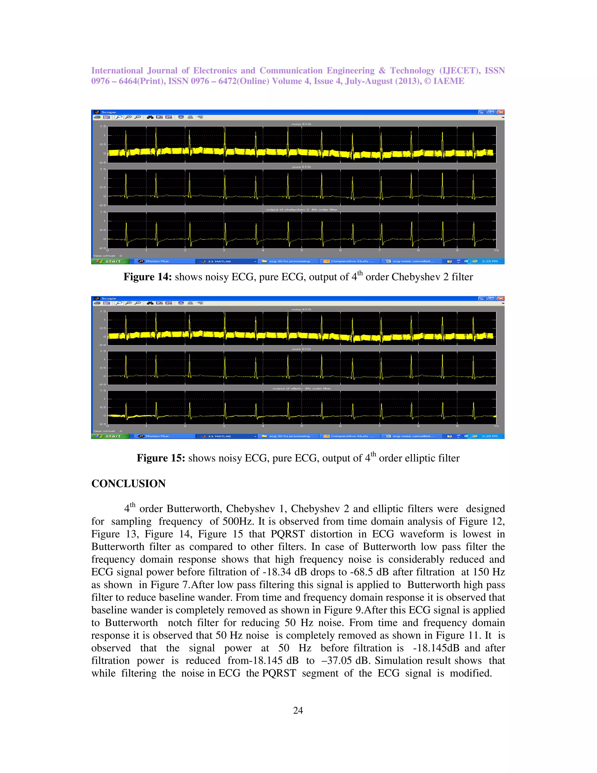 Noise reduction in ecg by iir filters a comparative study | PDF