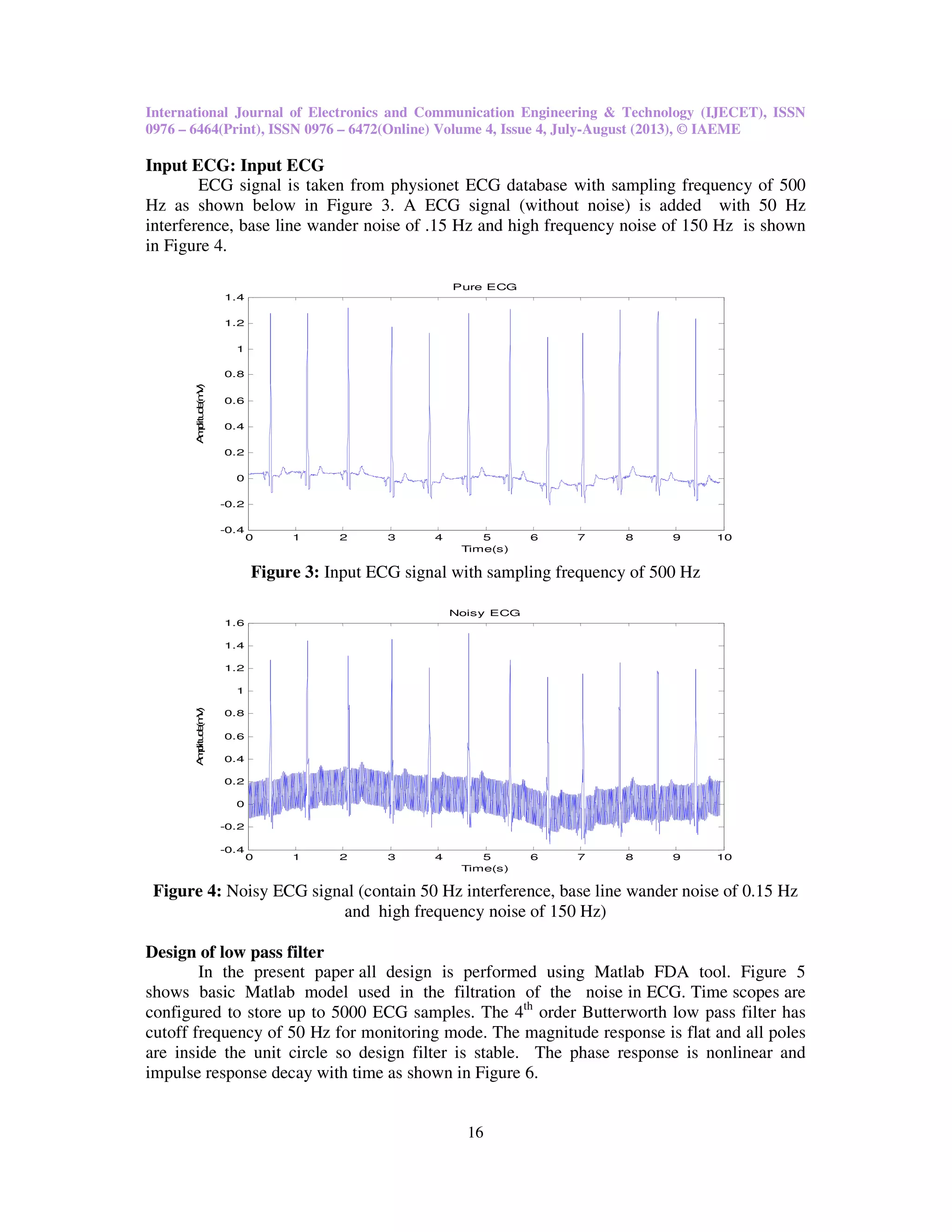 Noise reduction in ecg by iir filters a comparative study | PDF
