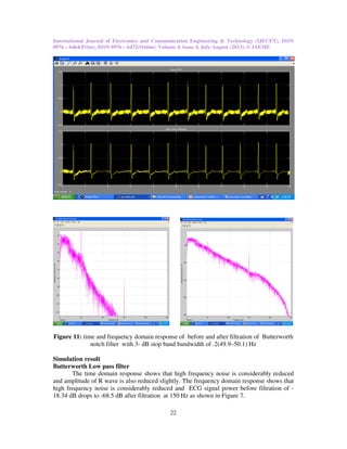 Noise reduction in ecg by iir filters a comparative study | PDF
