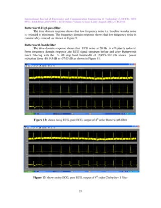 Noise reduction in ecg by iir filters a comparative study | PDF