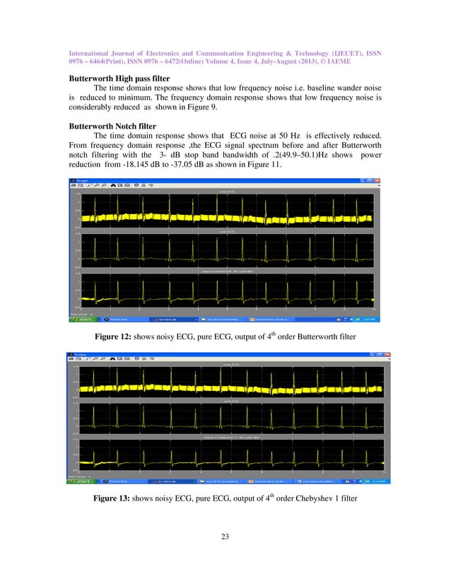 Noise reduction in ecg by iir filters a comparative study | PDF
