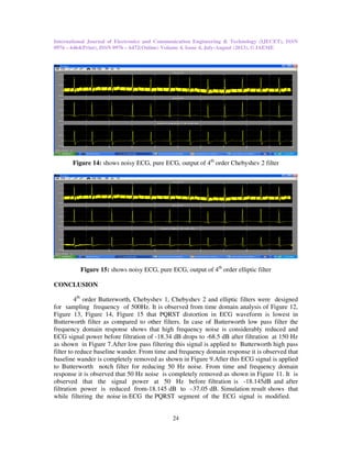 Noise reduction in ecg by iir filters a comparative study | PDF