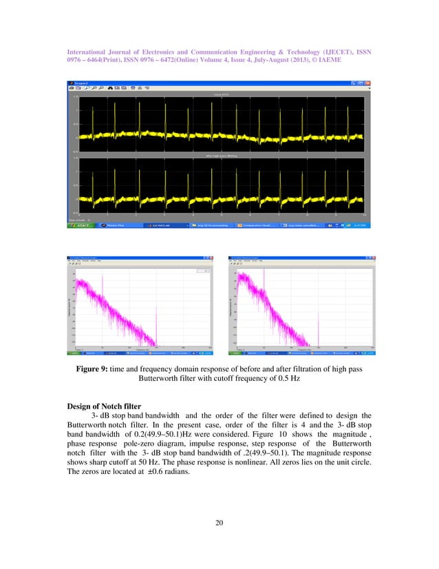 Noise reduction in ecg by iir filters a comparative study | PDF