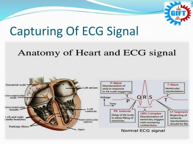 Noise removal using_ecg | PPT
