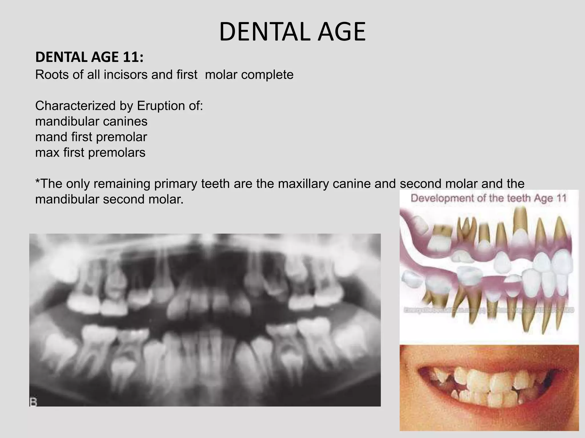 Nolla staging and Dental Age(Orthdontics) | PPTX