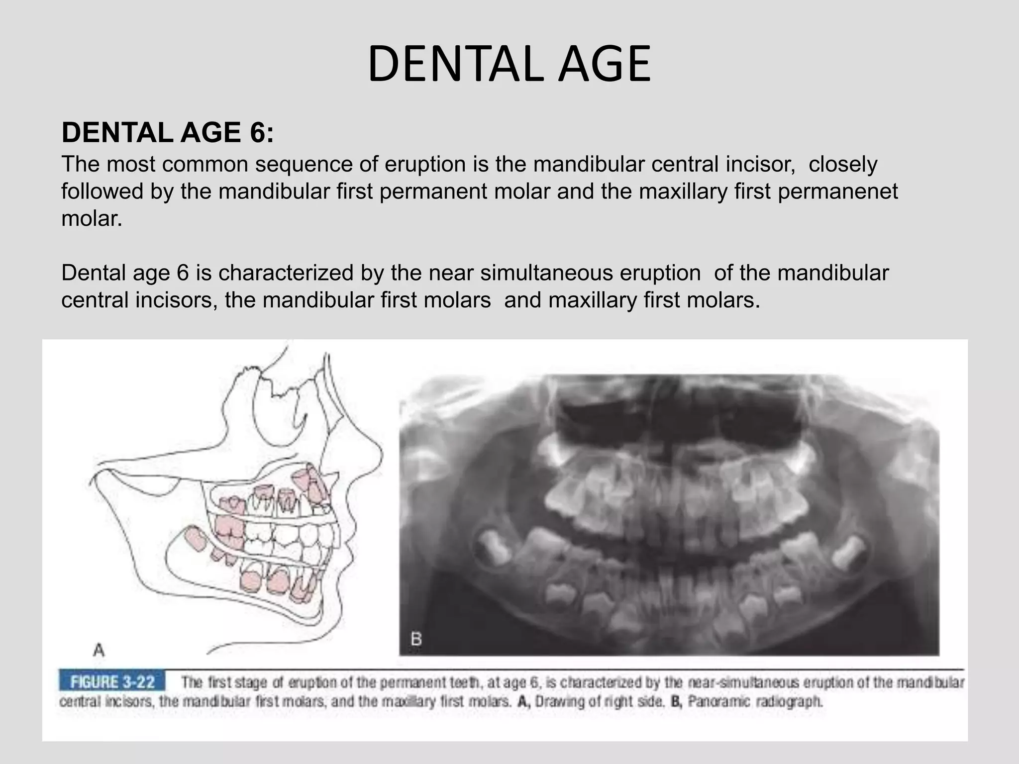 Nolla staging and Dental Age(Orthdontics) | PPTX