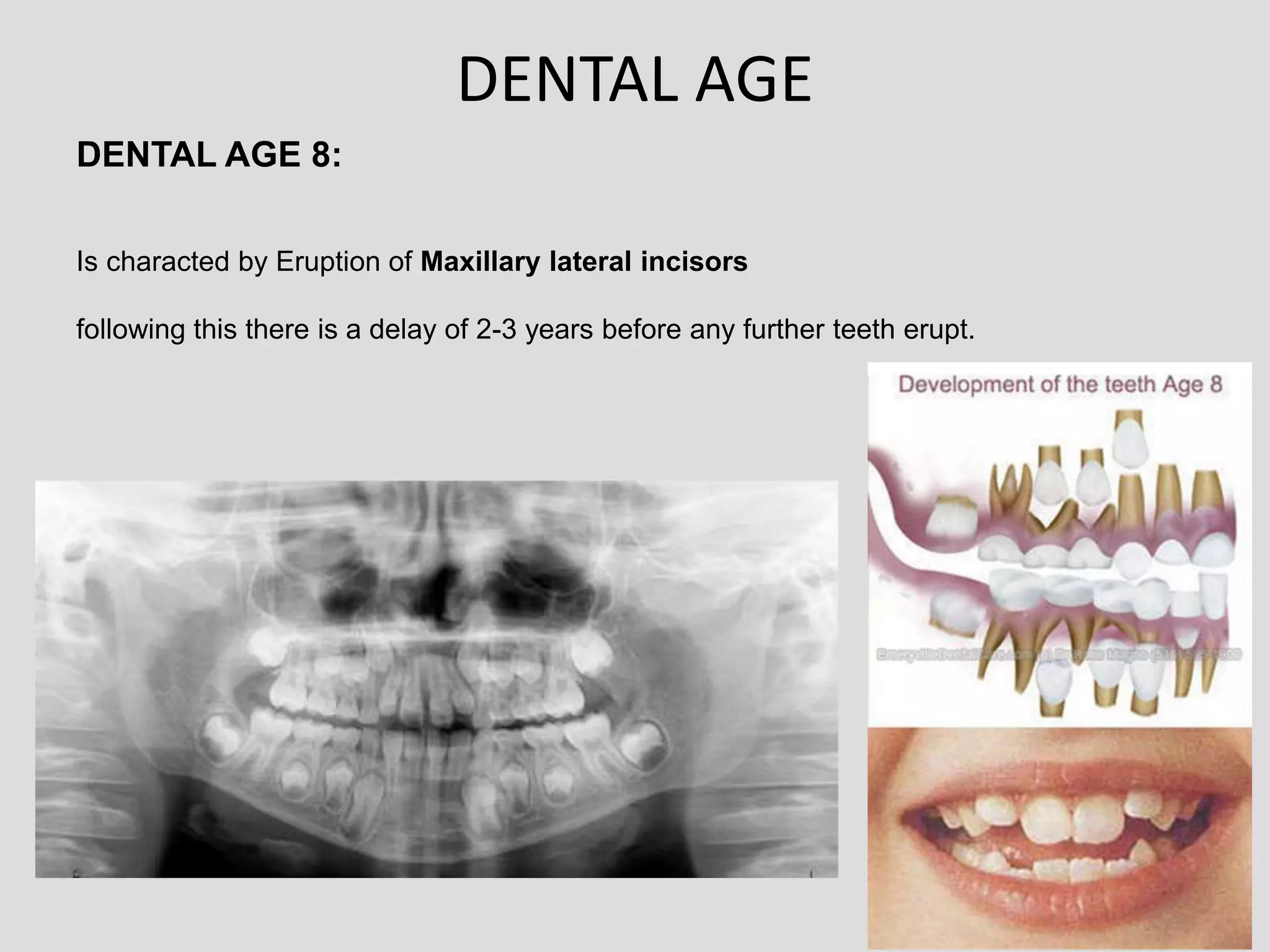 Nolla staging and Dental Age(Orthdontics) | PPTX