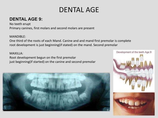 Nolla staging and Dental Age(Orthdontics) | PPTX