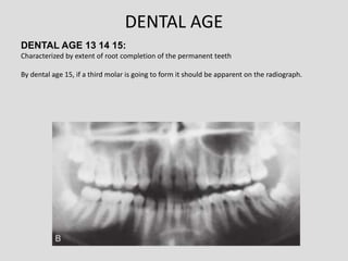 Nolla staging and Dental Age(Orthdontics) | PPTX
