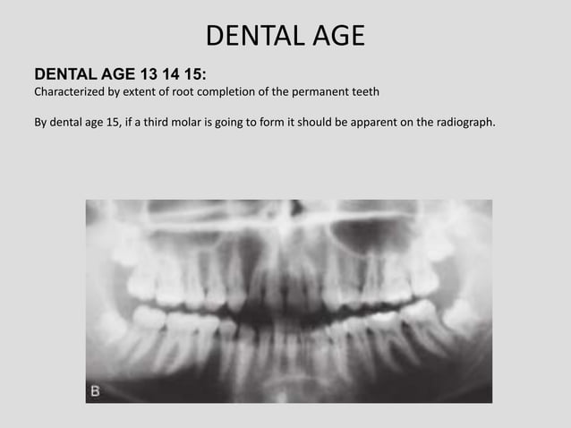 Nolla staging and Dental Age(Orthdontics) | PPTX