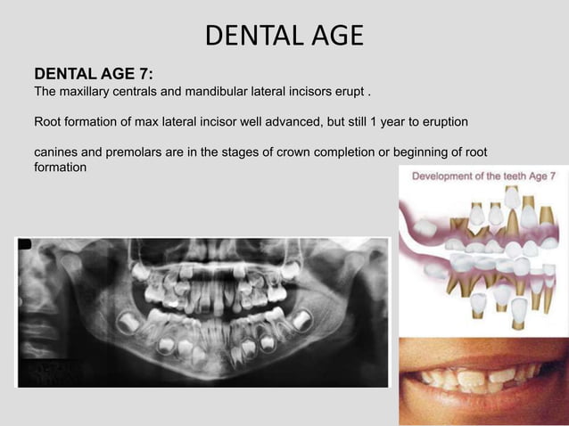 Nolla staging and Dental Age(Orthdontics) | PPTX