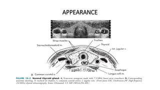 Thyroid Ultrasound and TIRADS | PPTX