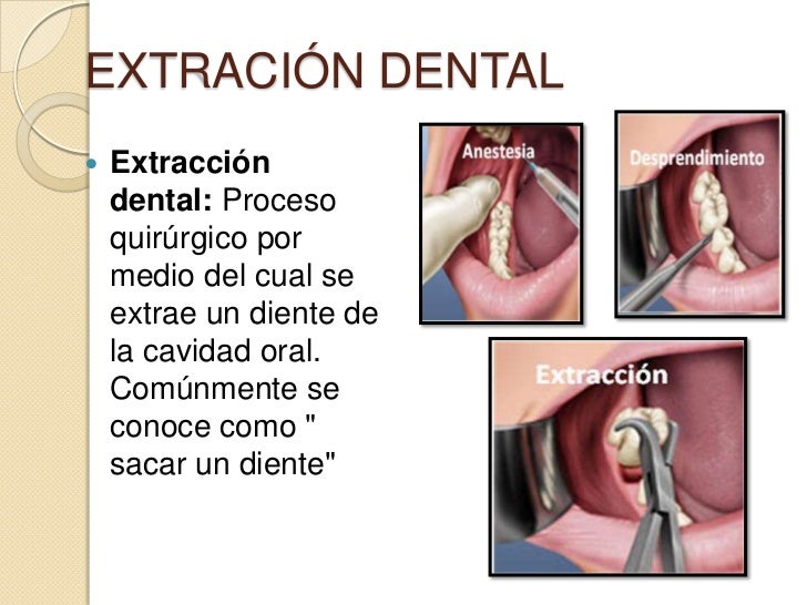 Nomenclatura dentaria 2