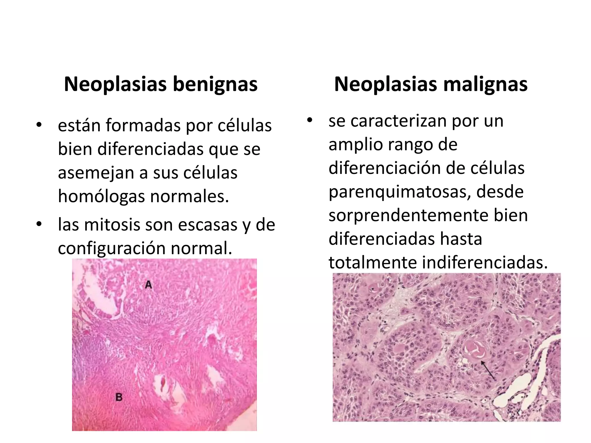 Nomenclatura, diferenciacion y anaplasia | PPTX