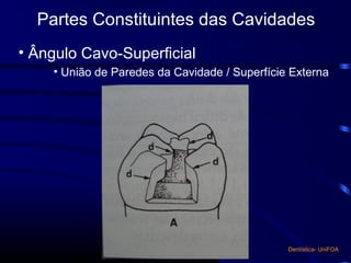 Nomenclatura e classificação das cavidades 2010 2 alunos | PPT