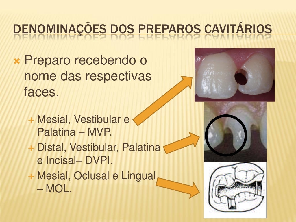 Nomenclatura e Classificação das Cavidades