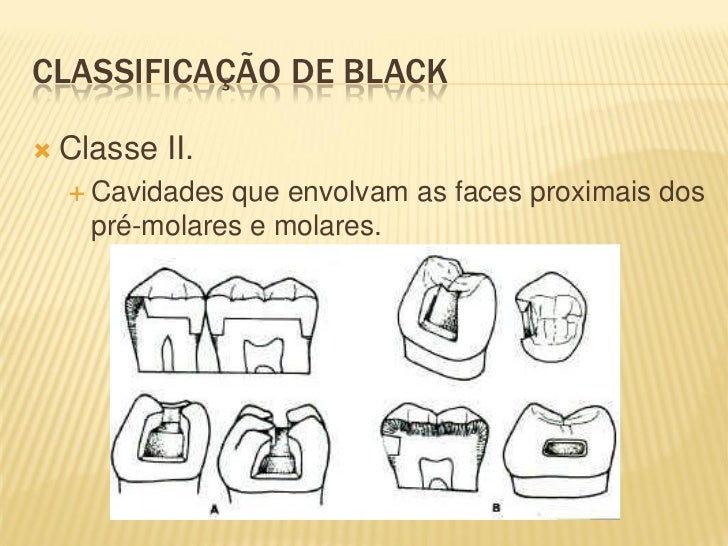 Nomenclatura e Classificação das Cavidades
