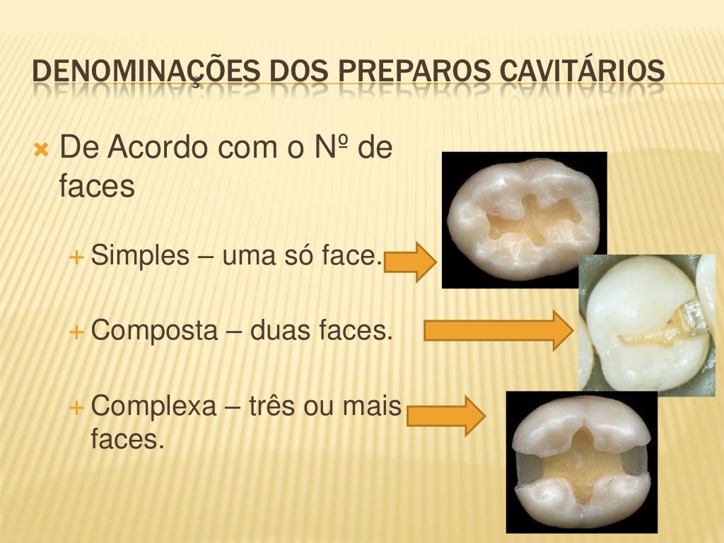 Nomenclatura e Classificação das Cavidades