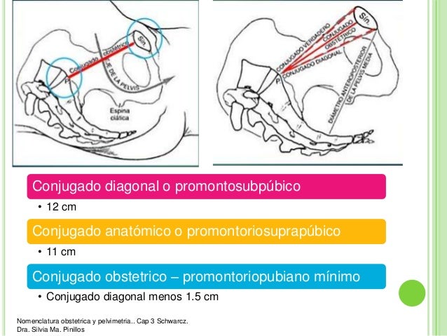 Nomenclatura obstétrica y pelvimetría