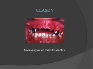 Nomenclatura y cariologia uasd 2010 1 restauradora | PDF