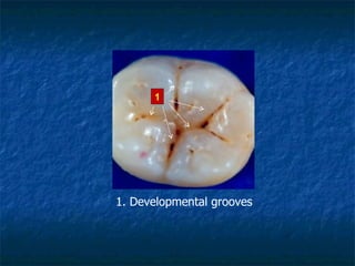 Dental Terminology | PPT