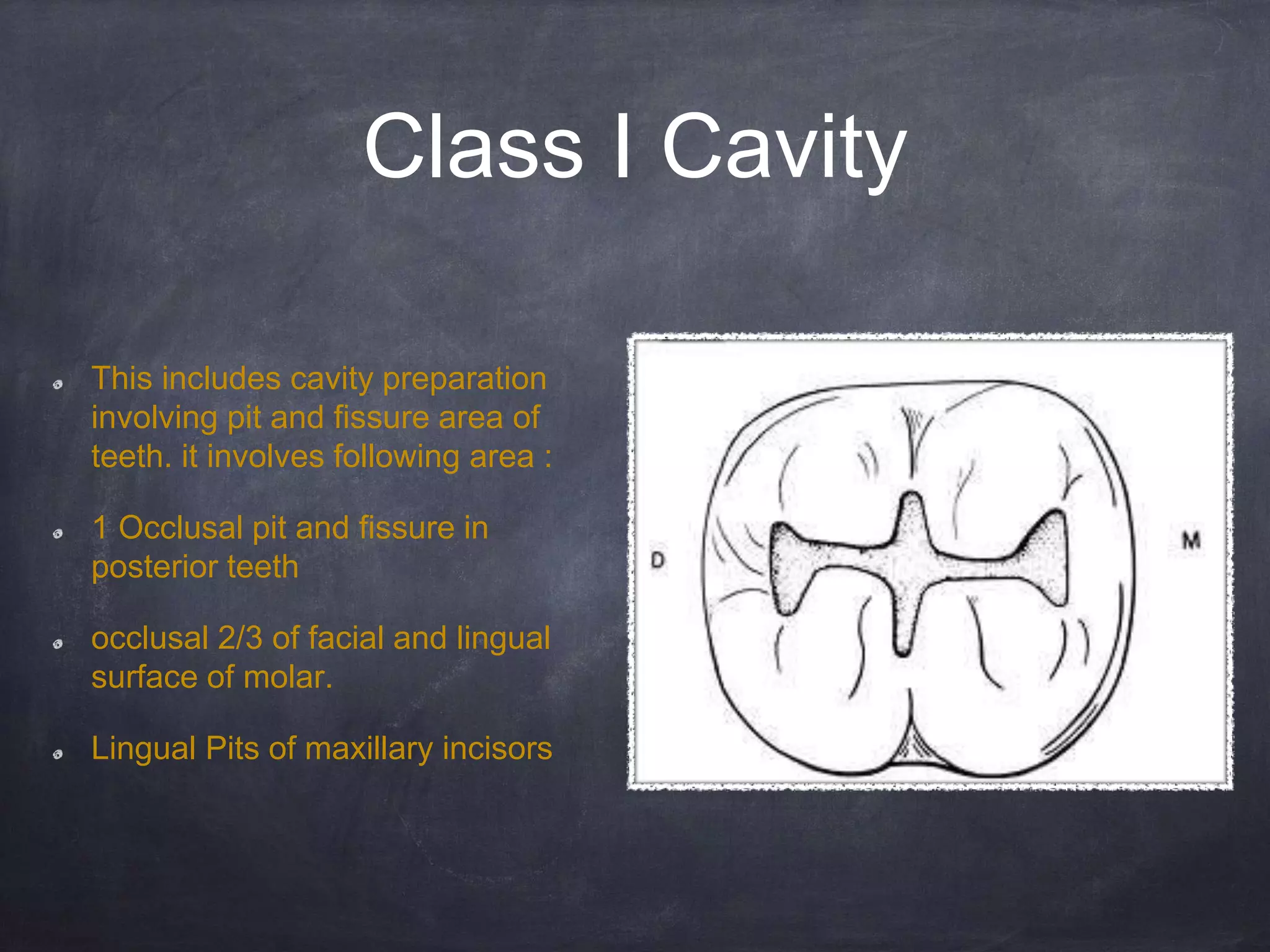 Nomenclature in Operative Dentistry | PPTX