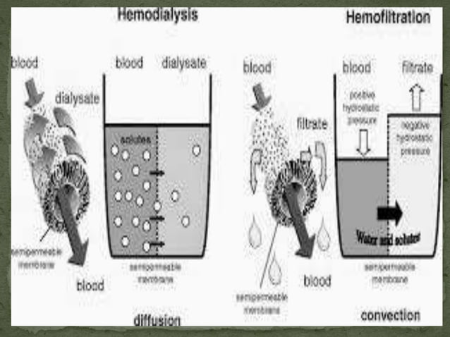Nomenclature c hd,c-hfc-hdf scuf sled clinical indications - copy ...