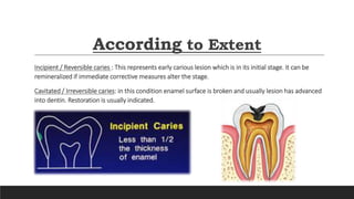 Nomenclature in operative dentistry | PPTX