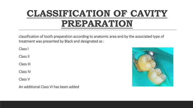 Nomenclature in operative dentistry | PPTX | Dental Health | Diseases ...