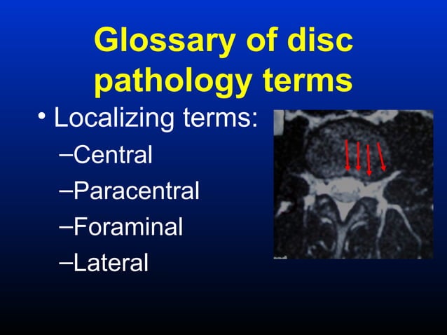 Nomenclature in spine mri | PPT