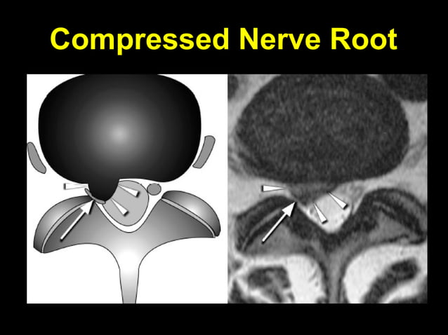 Nomenclature in spine mri | PPT